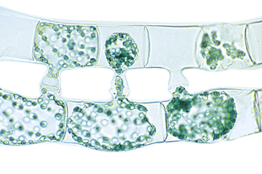 Planteceller, 12 mikropreparater - Cellemodeller, preparatsett ...