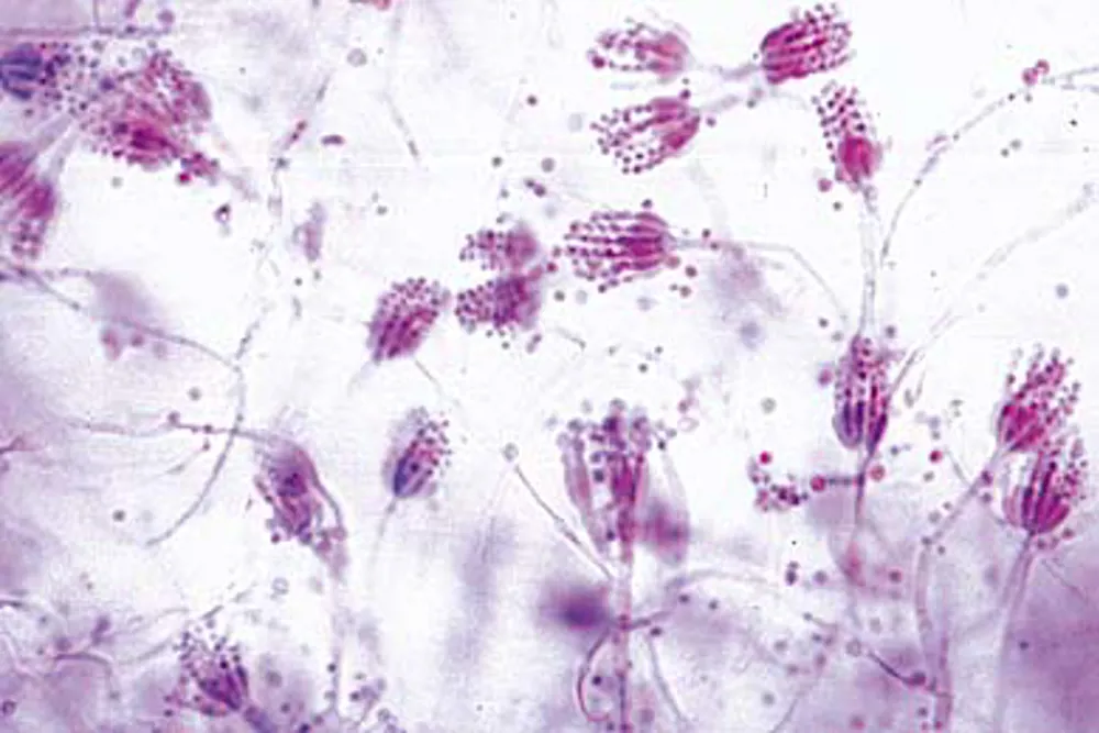 Preparaat Penicilium sporen en mycelium